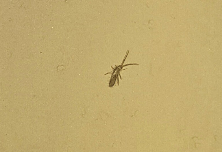 How To Get Rid Of Springtails In The Bathroom? - What's That Bug?